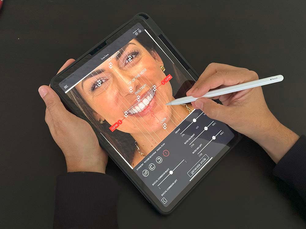 Smile Design | Smiles Of Boca